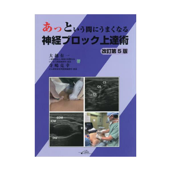 品名:あっという間にうまくなる神経ブロック上達術 改訂第５版出版社:シ-ビ-ア-ル著者:大越有一 寺嶋克幸発売日:2026/5/10価格:8030円(税込)判型:Ｂ５ISBN:9784911678053キーワード:アット イウ マ ニ ウマ...