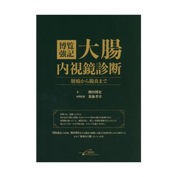 品名:博覧強記　大腸内視鏡診断　腫瘍から腸炎まで出版社:シ-ビ-ア-ル著者:樫田博史 筑後孝章発売日:2026/4/25価格:9020円(税込)判型:Ｂ５ISBN:9784911678060キーワード:ハクラン キョウキ ダイチョウ ナイシ...
