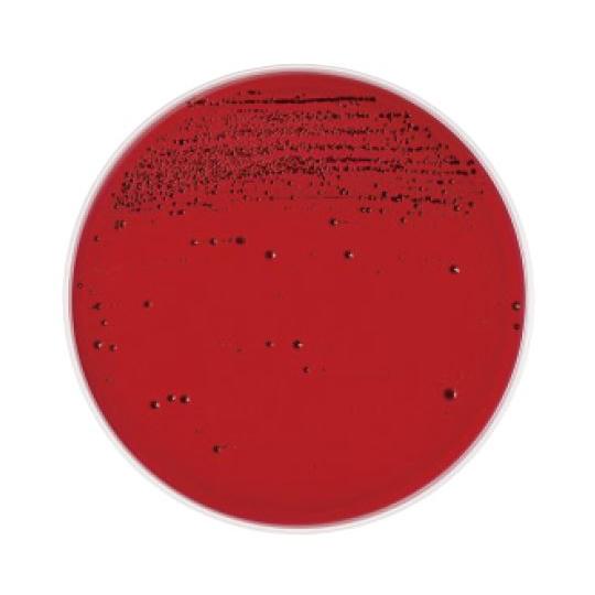 BD BBL TM アネロコロンビアRS血液寒天培地 10枚 ベクトン・ディッキンソン 252484 (63-6527-26) : A1 ...