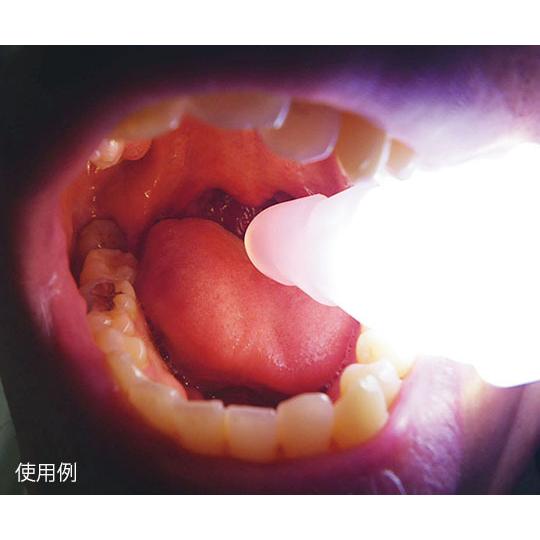バイトロック S デントケア DC-61 (7-5265-01) : A1ショップ 土日・祝日・夏季・年末年始休業 - 通販 - Yahoo!ショッピング