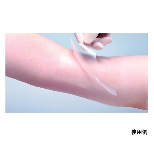 アルケア マルチフィックス 透湿・防水性サージカルフィルム 100×200mm 20枚 6号 16385 医療機器認証取得済 (8-5194-06) : A1ショップ 土日・祝日・夏季・年末 ...