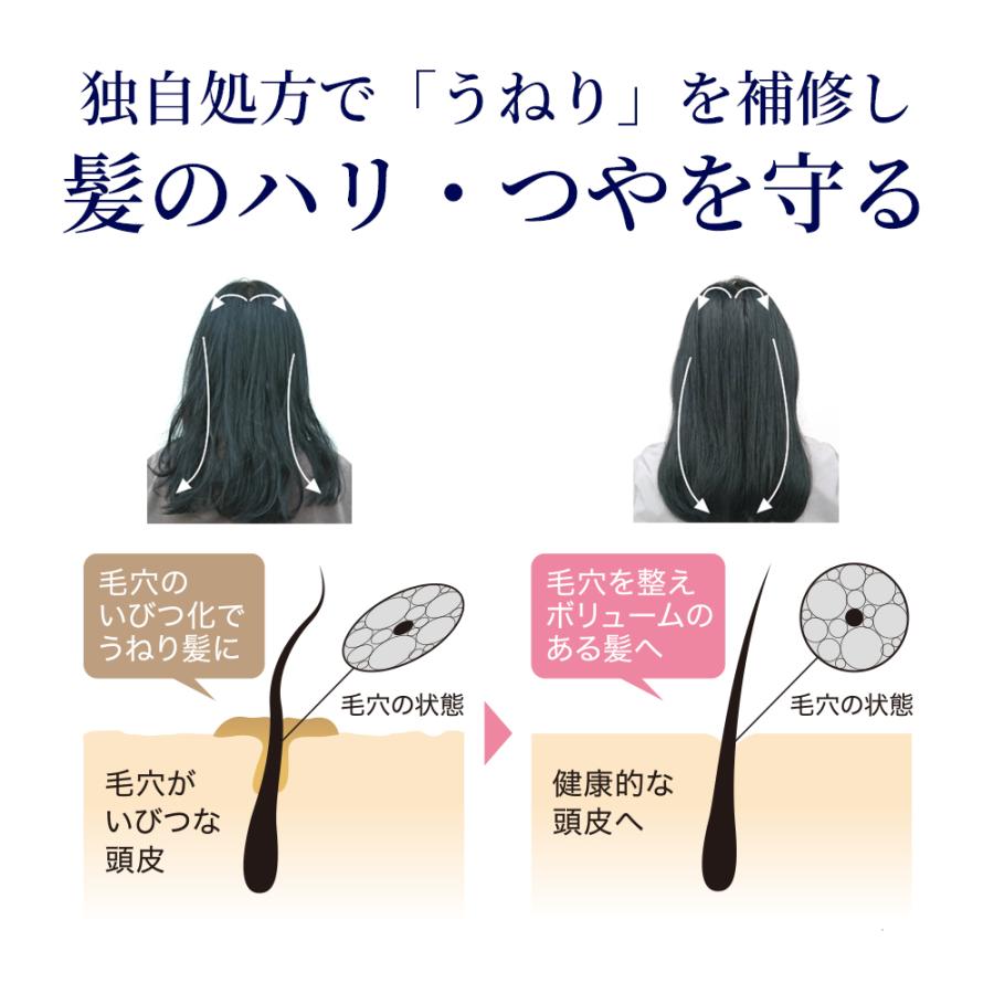 MUNOAGE ミューノアージュ スカルプシャンプー2本セット 200ml 女性用 レディース 30代 40代 50代 60代 [美容室専売 スカルプケア MUNOAGE] : 公式ミューノ ...