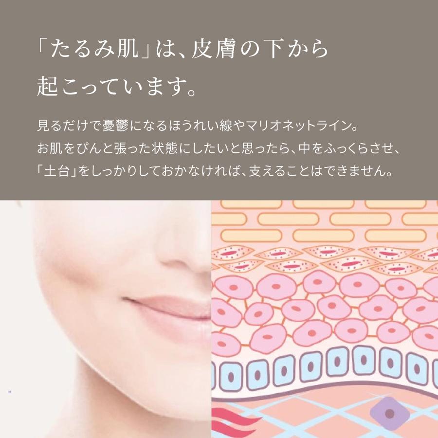 AOHAL（アオハル） リフトtcコンセントレイト ハリ うるおい 美容クリーム エイジングケア コラーゲン ヒアルロン酸 目元 口元 デコルテ 保湿 乾燥 敏感肌 : 美容皮膚専門店 ...