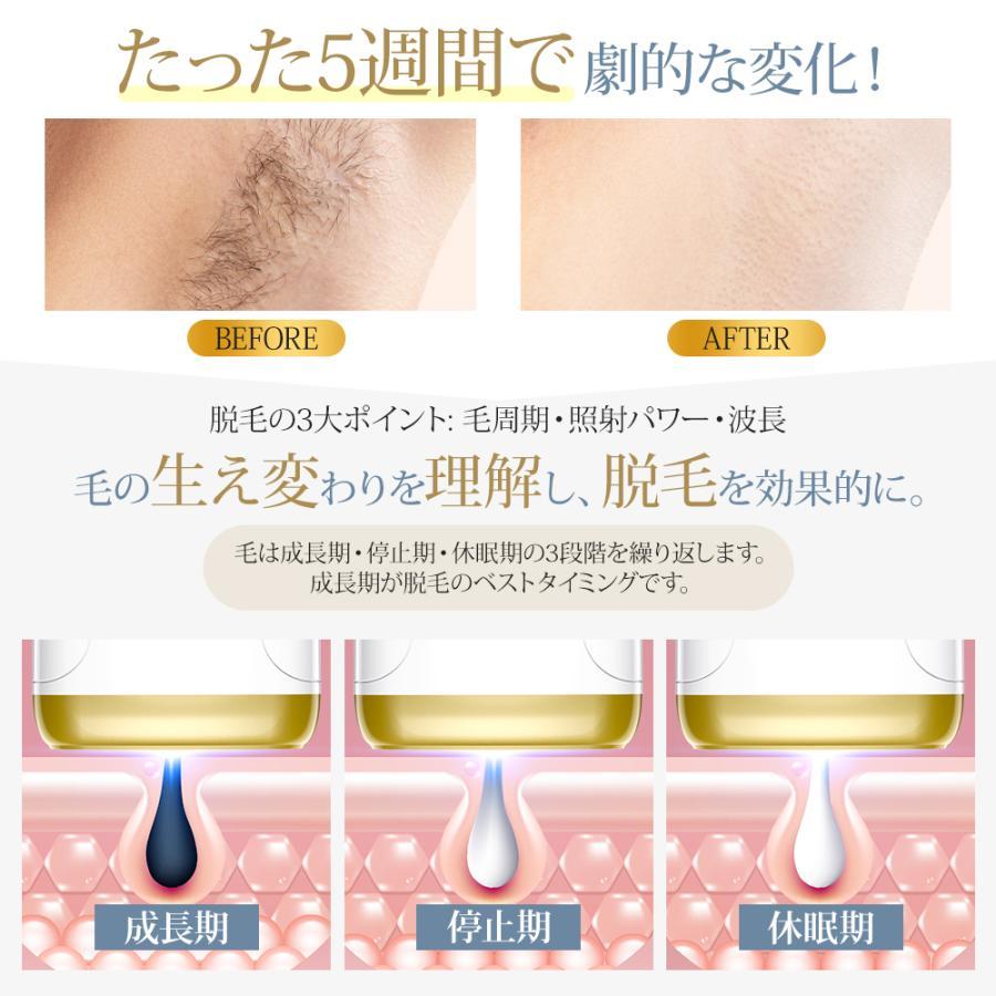 脱毛器 HIPL だつもうき VIO対応 連続照射 9段階調節 99万回照射 家庭用 全身用 顔 ワキ ヒゲ vio メンズ レディース 男女兼用 サングラス付き プレゼント : 葵ストア ...