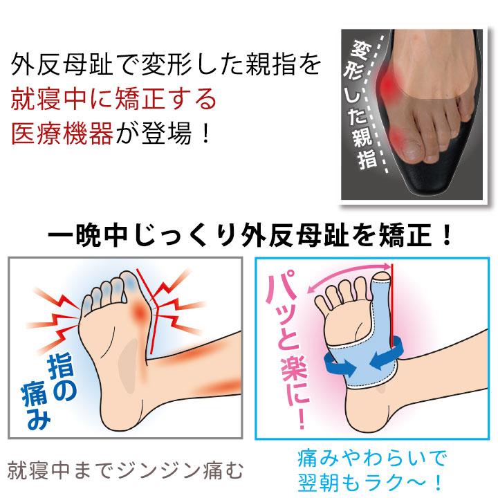 イザヴェル 夜用メディカル ゆびただし 片足 Z1852 外反母趾 サポーター 足指 足 親指 対策 矯正 予防 薄型 夜用 就寝用 アビバーレ : ステージ発表会衣装のアビバーレ - 通販 ...