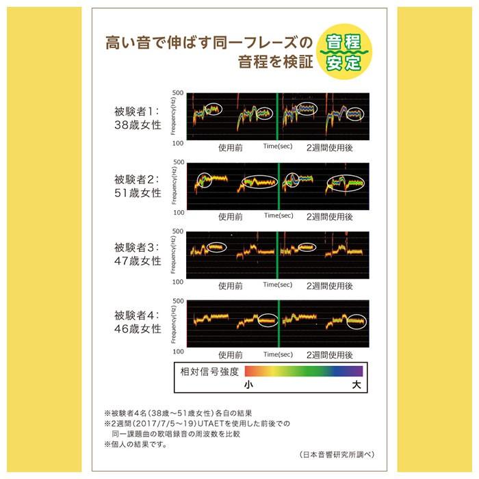 ボイストレーニンググッズ 通販 ウタエット UTAET ボイトレグッズ 消音機能 リアルボイス機能 ブレスリミット機能 カラオケ 練習 声帯 トレーニング 本気 : BACKYARD ...