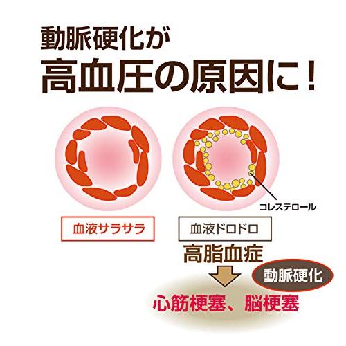 オムロン OMRON 上腕式血圧計 HEM-8731-N :4975479199240:World Free Store - 通販 - Yahoo!ショッピング