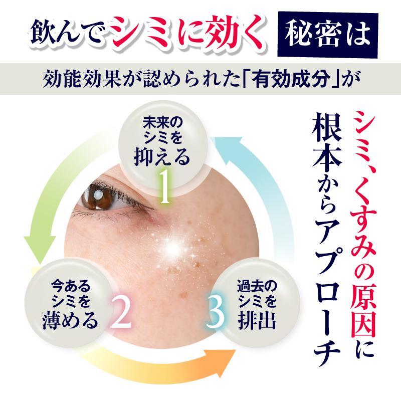 【第3類医薬品】プルオイプレミアムホワイト（60錠）シミ シミ取り システイン Lシステイン シミの薬 日焼け そばかす 色素沈着 くすみ 美白 ビタミンC : 母の葉薬品 - 通販 ...