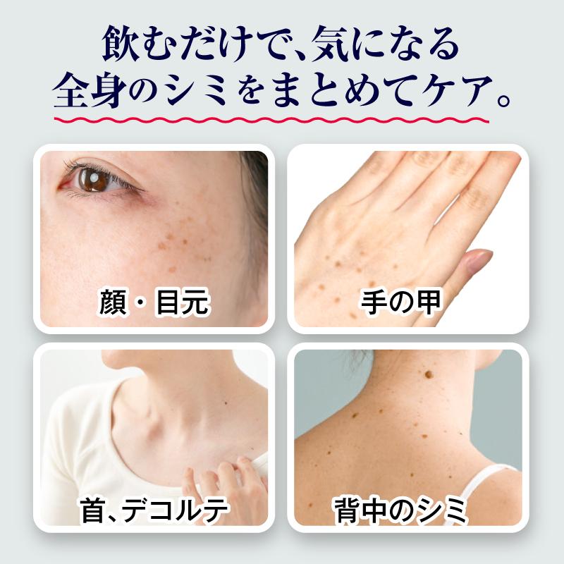 【第3類医薬品】プルオイプレミアムホワイト（30日分180錠）シミ そばかす Lシステイン シミの薬 日焼け 色素沈着 くすみ 美白 ビタミンC :ym-pw-30d180-tp01:マザー ...