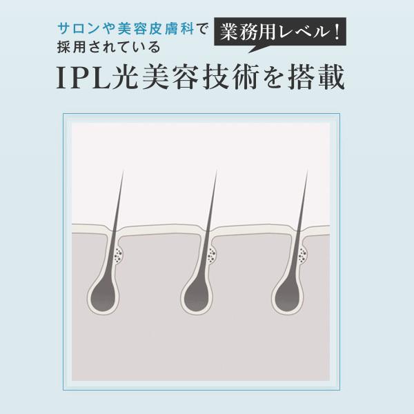 LINKA 【残り1台】 脱毛器 永久脱毛 家庭用脱毛器 リンカ 保証付き IPL Hair Remover IPL光脱毛器 エピゼロ IPL光脱器 自動照射 男女兼用 髭 脇 腕 足 背中 ...