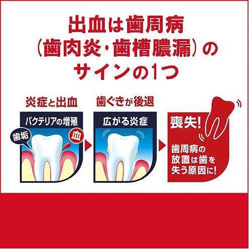 GSK CHJ カムテクト 歯ぐきケア 1400ppm 歯磨き粉 115g : 9618400011 : ベスト電器Yahoo!店 - 通販 - Yahoo!ショッピング
