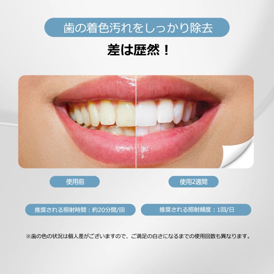 歯 ホワイトニング LED ライト 歯を白くする マウスピース 白く 歯 ホワイトニング LED ライト 歯を白くする マウスピース 白く
