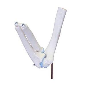 3B社 人体模型 小型関節模型 肘関節ミニモデル断面レリーフ・スタンド付 (a87-1) 鍼灸 模型 :a87-1:Shop de Clinic - 通販 - Yahoo!ショッピング