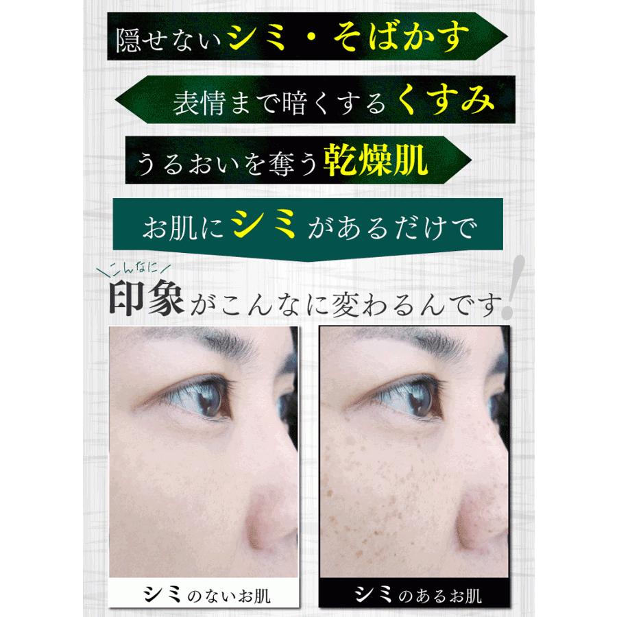 エメラポ オーロラゲルクリーム 80g 乾燥 肌バリア スキンケア 高保湿 送料無料 : Dr.Secret - 通販 - Yahoo!ショッピング