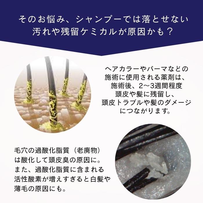 シコナーゼ enz-SQ 本体 300ml エンザエスキュー エンザ エスキュー 酵素 旧Premush 旧プリムシュ ローション スカルプ ヘア 頭 : 美容雑貨Cabfive - 通販 ...