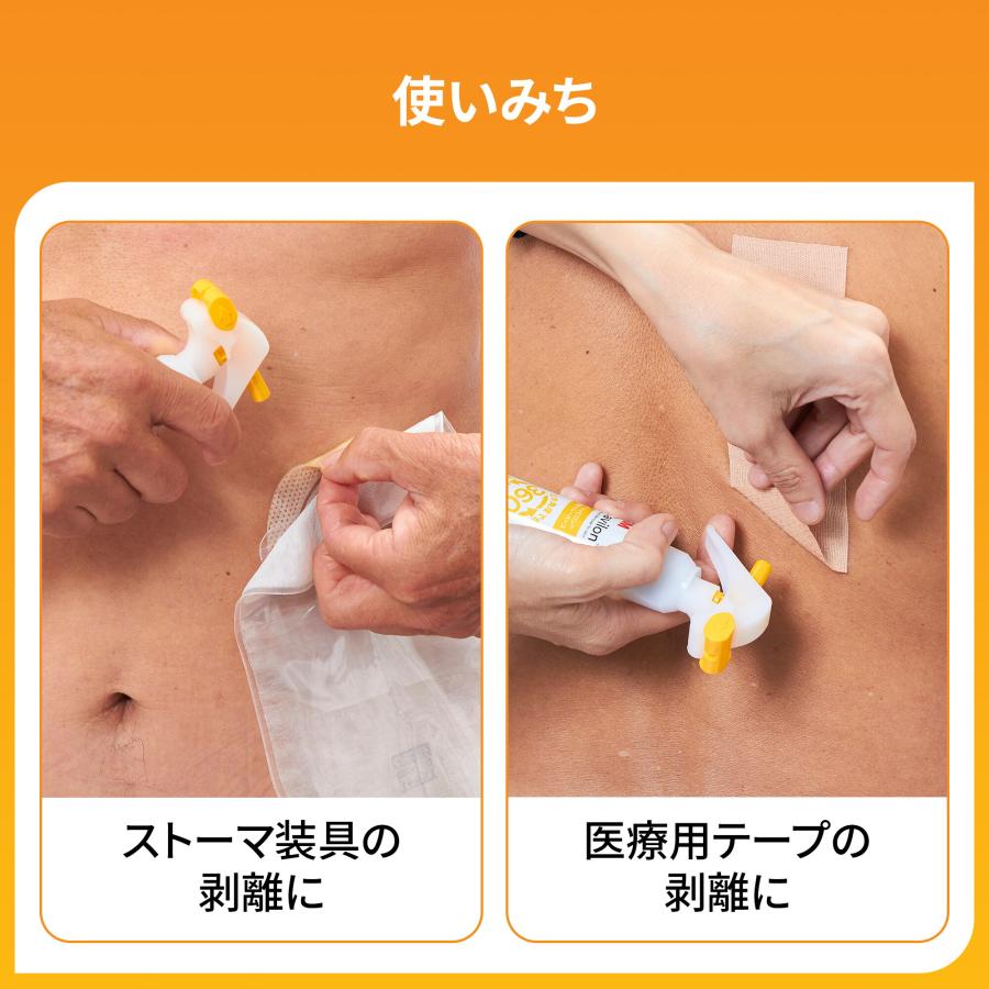 【国内正規品】キャビロン 皮膚用リムーバー 滴下 ボトル TP1 30ml 1本 サージカルテープ 剥離剤 テープ剥がし ストーマ装具剥がし : マツヨシ - 通販 - Yahoo!ショッピング