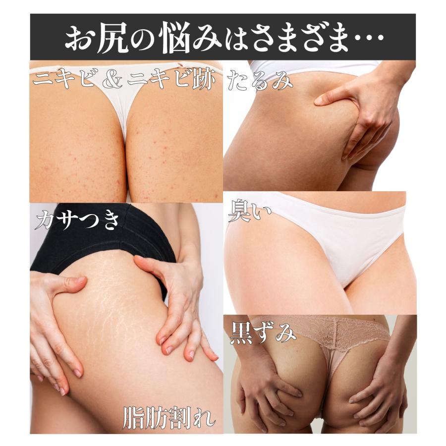 Cosmejitan 【敏感肌でも使える 薬用 デリケートゾーン ボディスクラブ】薬用ヒップスリップ ボディソープ ヒップケア お尻 角質 AHAビタミンC ヒップスリップ ポイント利用 ...