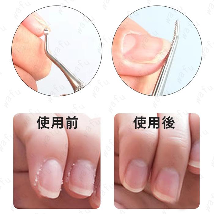 爪垢取り 3点セット 日本国内当日発送 爪リフター 甘皮処理 爪やすり 巻き爪 厚い爪 足 爪ケア 爪垢とり ネイルケア 陥入爪ツール ステンレス製 #br164 : br164 ...