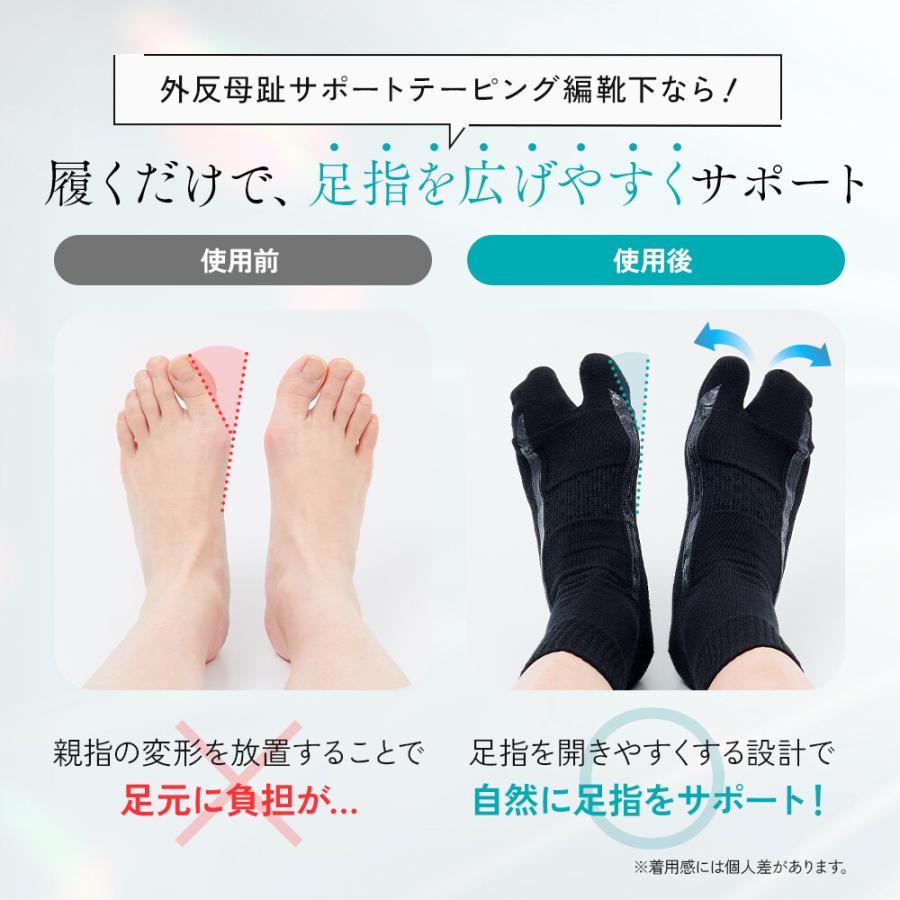 アイメディア 外反母趾サポートテーピング編靴下 ソックス 外反母趾 サポート 足指 広げる 足袋 ショート丈 薄手 ズレにくい 履き口 やわらか ブラック 日本製 レディース : いいもの福キ ...