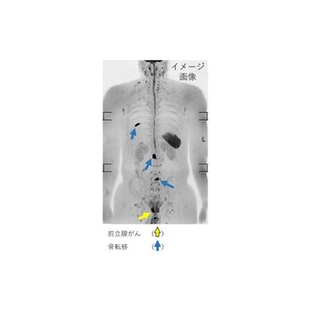 ふるさと納税 全身DWIBS検査 0112-001-S06 東京都新宿区 : ふるなび(ふるさと納税) - 通販 - Yahoo!ショッピング