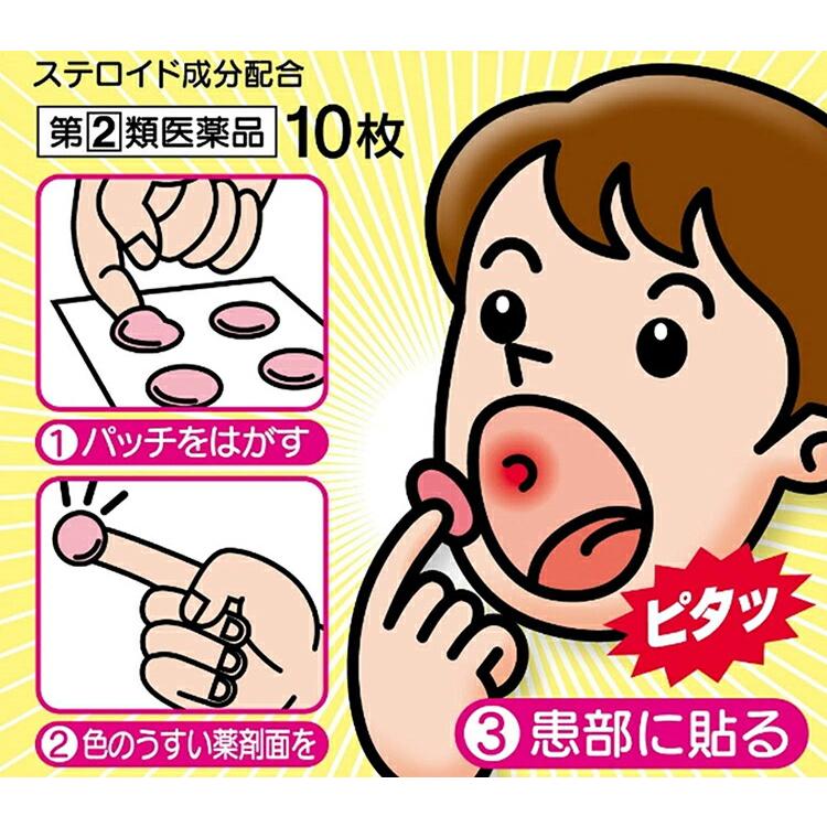 第(2)類医薬品 ★口内炎パッチ大正クイックケア 10枚 : 4987306019508 : Goodsaniaマック土居店 - 通販 ...