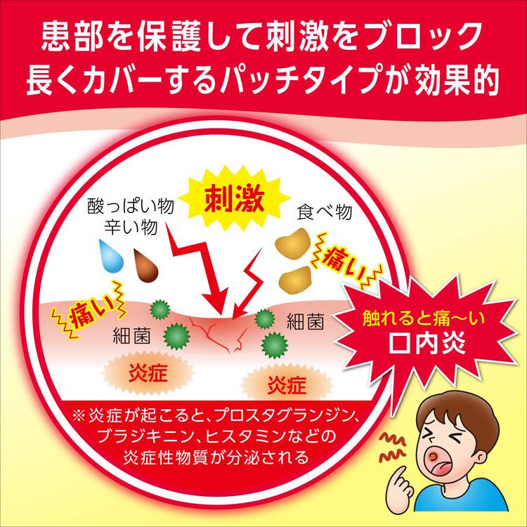 第(2)類医薬品 ★口内炎パッチ大正クイックケア 10枚 : 4987306019508 : Goodsaniaマック土居店 - 通販 ...