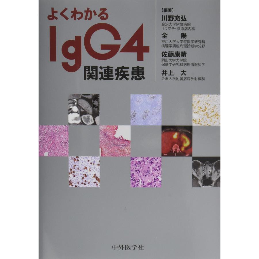 よくわかるIgG4関連疾患 : ぽちっとほわっと - 通販 - Yahoo!ショッピング