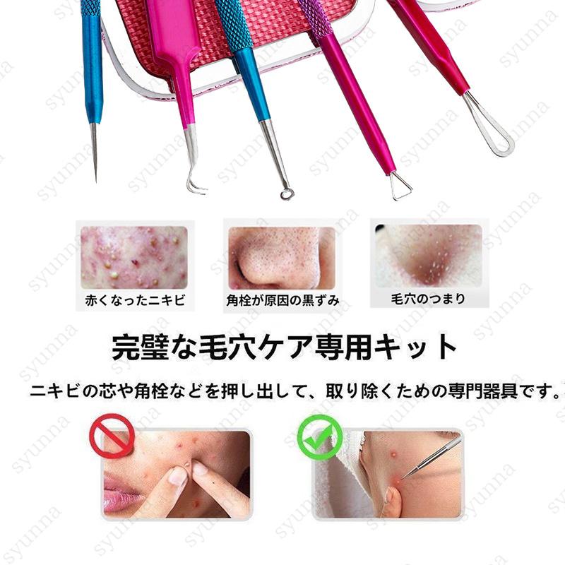 毛穴ケア専用キット (br25#) 日本国内当日発送 5本set ニキビ針 角栓プッシャー にきび針 黒ずみ取り ニキビ取り コメドプッシャー 専用ケース付き 送料無料 : hanae19 ...