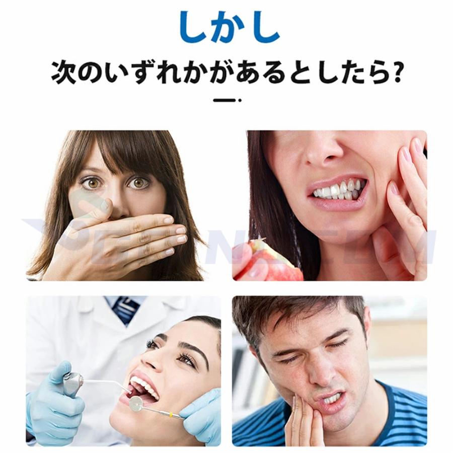 口腔洗浄器 歯垢除去 オーラルケア 口内洗浄機 家庭用 口臭を防ぐ 歯周ポケット 歯間 シンプル 10段階水圧調節可能 800ml大容量 改良版 2024 PSE認証 : OrangeMary ...