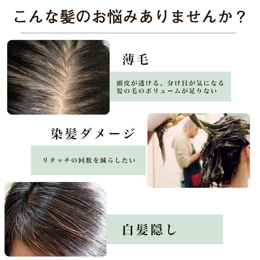 ヘアピース 頭頂部 ウィッグ 人毛100% 自然 つむじ ショート ヘアピース 頭頂部 ウィッグ 人毛100% 自然 つむじ ショート