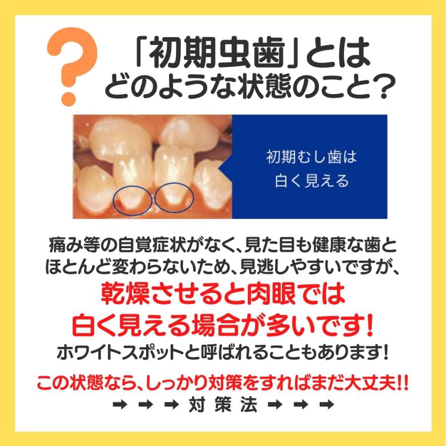 【まとめ買い】 スマイルコスメティック ホワイトニングペースト 85ml×4個 フッ素1450ppm配合 虫歯予防 歯 ホワイトニング 美白 口臭 [医薬部外品] 口臭ケア ...