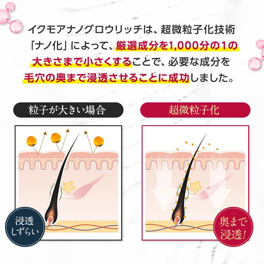 イクモア ナノグロウリッチ 女性用育毛剤（医薬部外品）130mL 約30日分｜送料無料・女性用 ヘアケア 医師監修ブランド・iqumore 公式 : iq-ngr-30-tan : イクモール ...