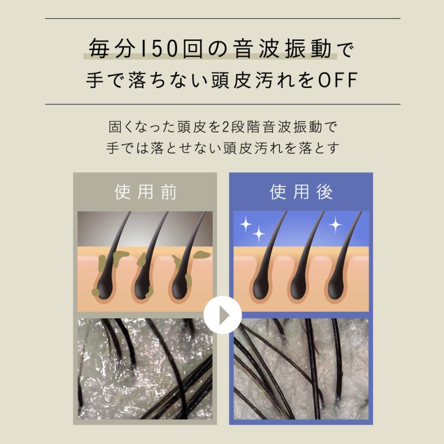 Noend \MONOQLOベストバイ受賞／Noend リフトヘッドスパ 軽量226g ヘッドマッサージャー 防水 リフトアップ 頭皮ケア ヘッドスパ マッサージ器 : Noend(公式 ...