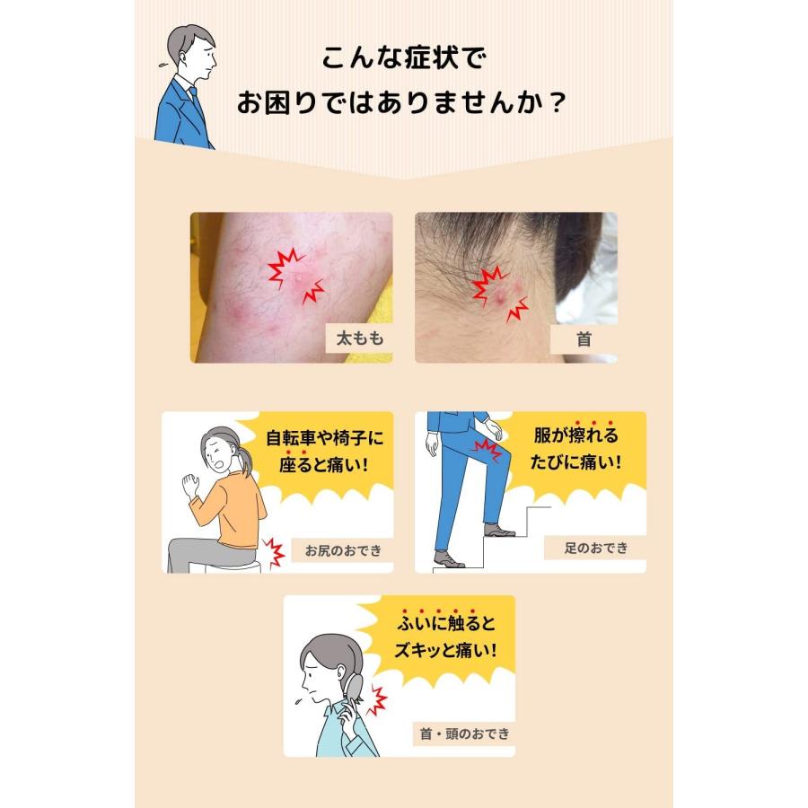 【第2類医薬品】オデキュアEX 12g (002954) :4987426002954-01:ジェットドラッグ - 通販 - Yahoo!ショッピング