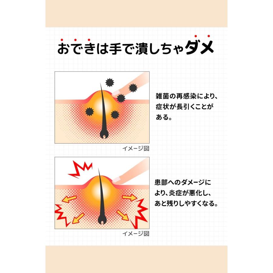 【第2類医薬品】〔かぶれ 皮膚炎〕オデキュアEX 12g ×4個 (002954) :4987426002954-04:ジェットドラッグ - 通販 - Yahoo!ショッピング