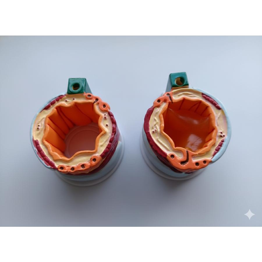 医学模型 COPD GPI Anatomicals : 人体百科ヤフー店 - 通販 - Yahoo!ショッピング