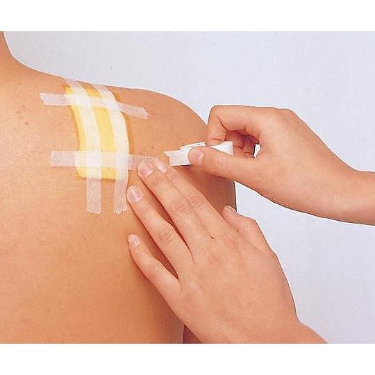 ミリオンエイド サージカルテープ 12mm×9m LM-E0129T(0-2310-11) 返品種別A : Joshin web - 通販 - Yahoo!ショッピング