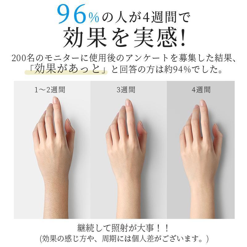 2024最新 vio対応 21Jパワー 全身快速脱毛 サロン級HIPL＆サファイア氷感 冷感 5段階レベル 5種類照射モード : p211236207433 : 帝京ショップ - 通販 ...