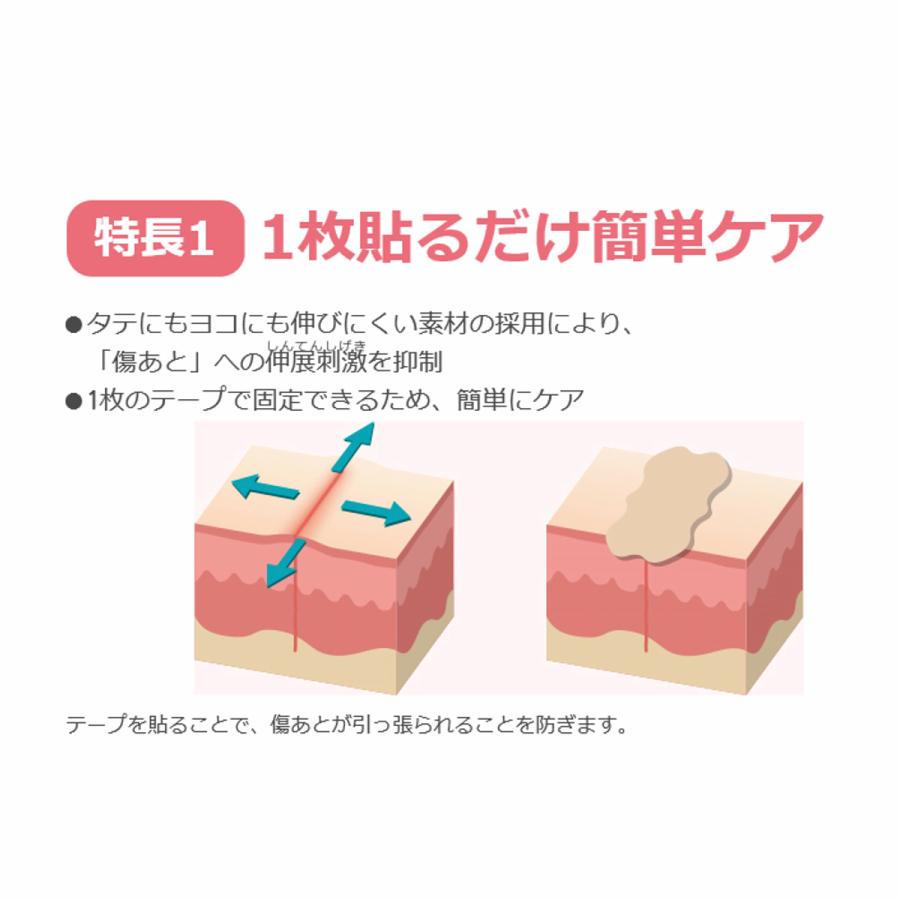 アトファイン ニチバン アトファイン Ato fine SSサイズ（〜1.5cmの傷あとに）24枚入 C : マービー商会 - 通販 - Yahoo!ショッピング