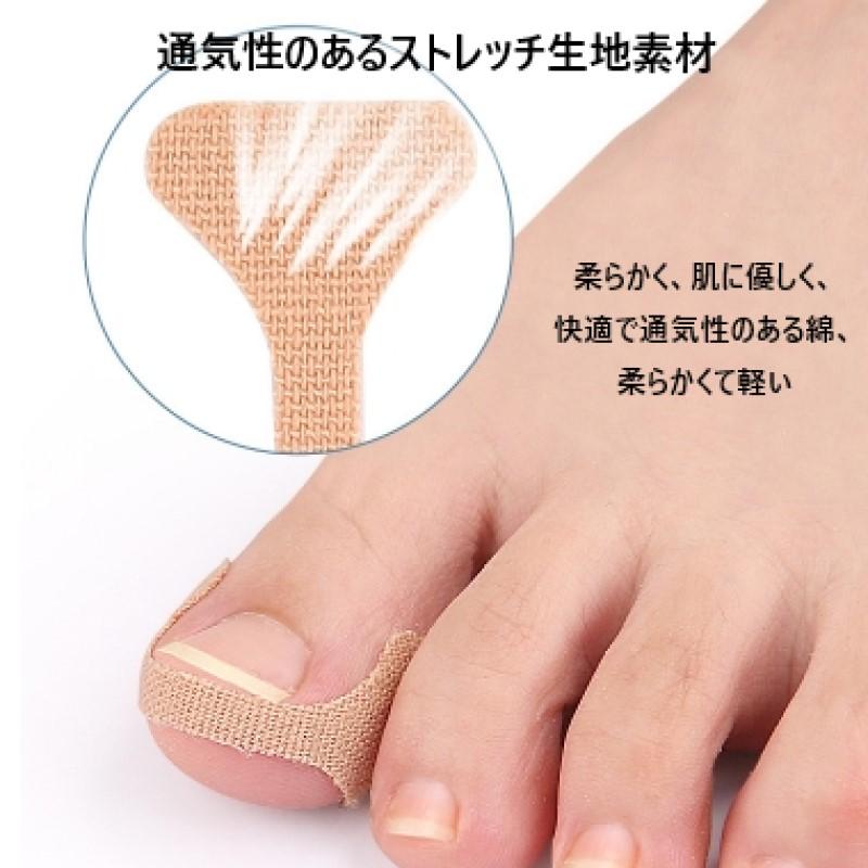 Mies′ 巻き爪テープ 蝶型100枚入り I型25枚入り 強粘着で通気性の素材 簡単貼るだけ まきづめ対策 陥入爪 巻爪 爪テープ : ミイズ セレクトショップ - 通販 - Yahoo ...