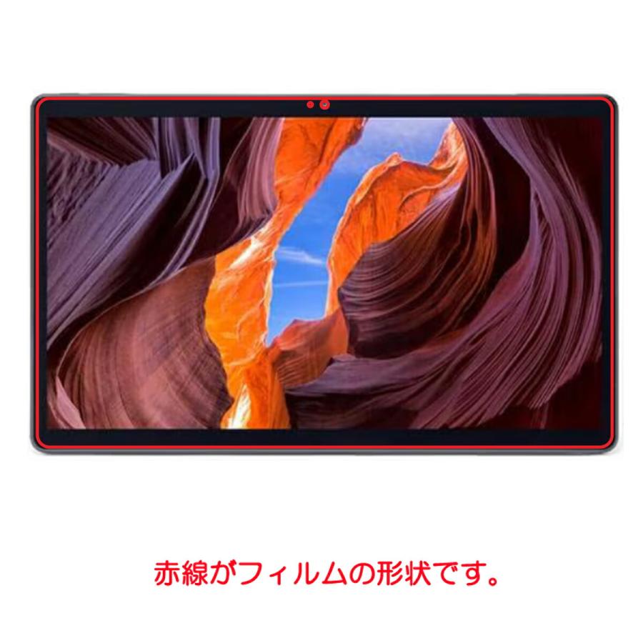 アイリスオーヤマ TM153M6V1-B 用 N40 高機能反射防止 液晶保護フィルム ポスト投函は送料無料 : モバイルウィン - 通販 - Yahoo!ショッピング