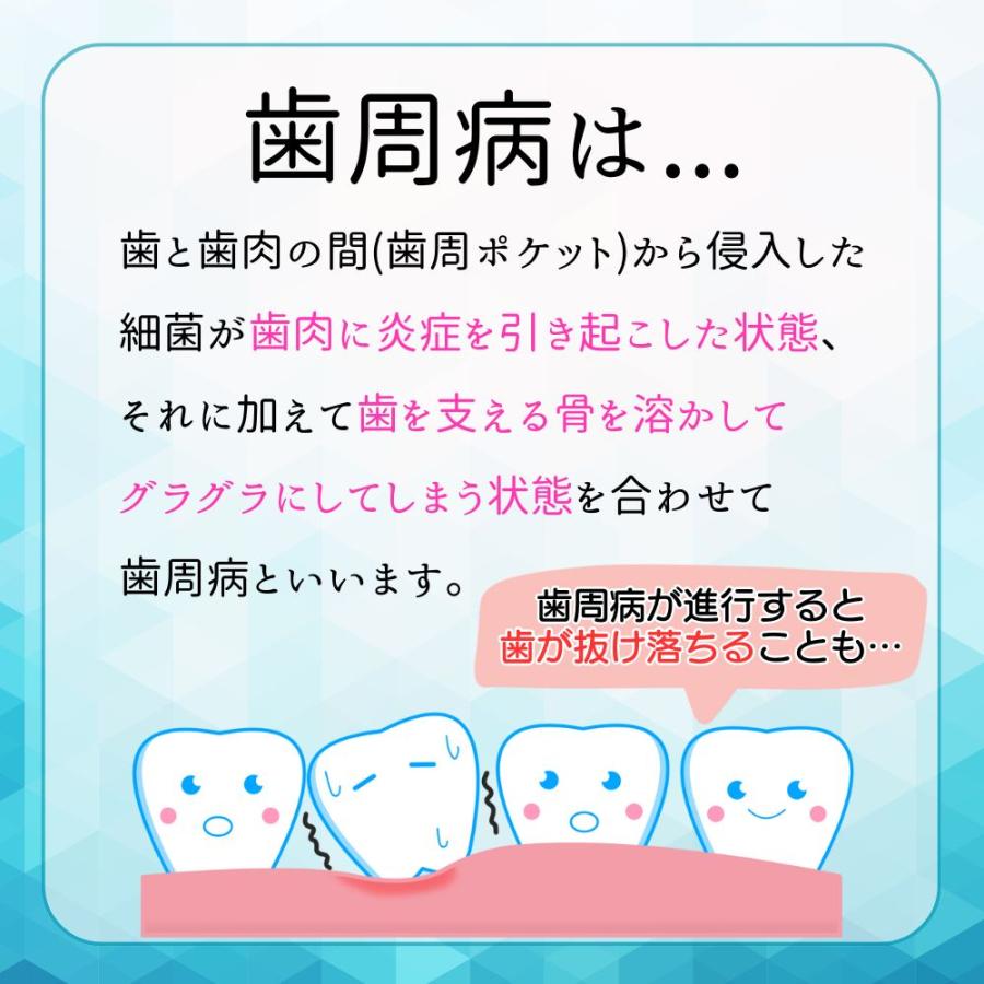 システマ ライオン デント SP-T ジェル 85g LION Systema SP−T sptジェル 歯科専売品 : お口の専門店 - 通販 - Yahoo!ショッピング