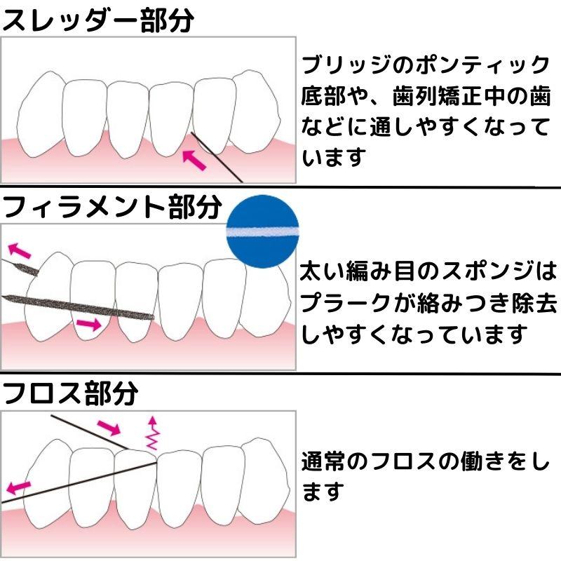 Proxysoft プロキシソフト ソートン ブリッジクリーナー インプラントクリーナー 2in1 スレッダー B&Iタイプ 歯間フロス デンタルフロス 30本入り 輸入品 : KKPLヤフー ...