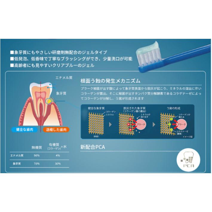 ライオン チェックアップ ルートケア 90g 3個セット フッ素1450ppm : 10000749 : ピュアデント - 通販 ...