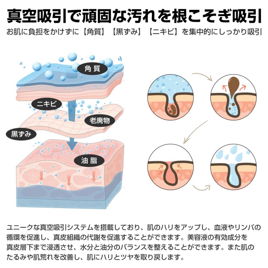 RABLISS 【在庫限り】 毛穴吸引器 毛穴ケア 毛穴クリーナー 美顔 RABLISS 【在庫限り】 毛穴吸引器 毛穴ケア 毛穴クリーナー 美顔