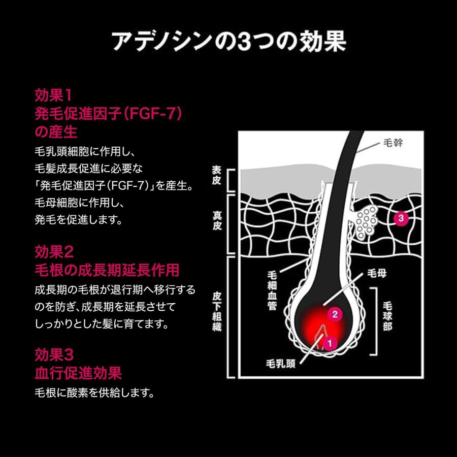 アデノゲン (ADENOGEN) 薬用EX 300mL 【医薬部外品】 : ルビアオンライン - 通販 - Yahoo!ショッピング