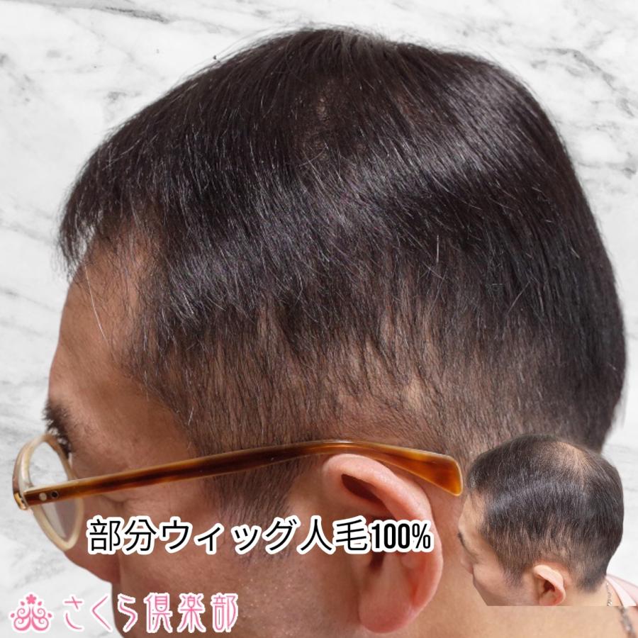 さくら倶楽部 メンズ 部分ウィッグ 人毛100% Sサイズ top-s さくら倶楽部 メンズ 部分ウィッグ 人毛100% Sサイズ top-s