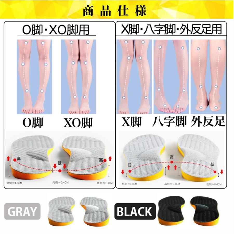 インソール O脚 X脚 O脚矯正 O脚補正 XO脚 扁平足 八字脚 外反足 インソール O脚 X脚 O脚矯正 O脚補正 XO脚 扁平足 八字脚 外反足