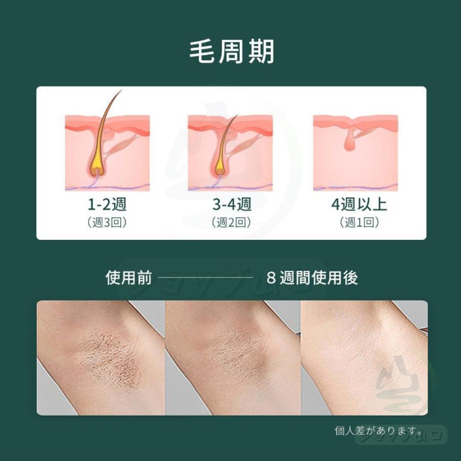 脱毛器 脱毛機 ipl光脱器 無痛脱毛器 サロン級 女性 メンズ 5段階調節