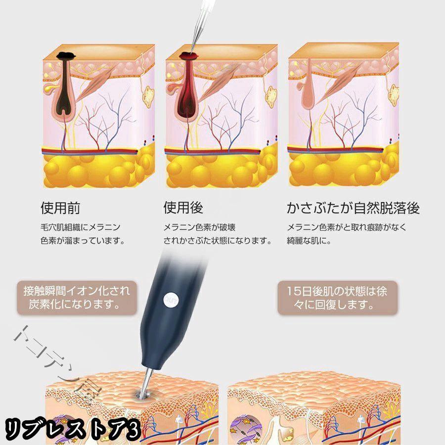 美顔器 ミニケア シミ取り イボ シミ ほくろ除去ペン スポットペン 9階段調整 液晶ペン ライト付き セルフ 無痛感 美肌 美容 USB充電式 家庭用 : StayGold - 通販 ...